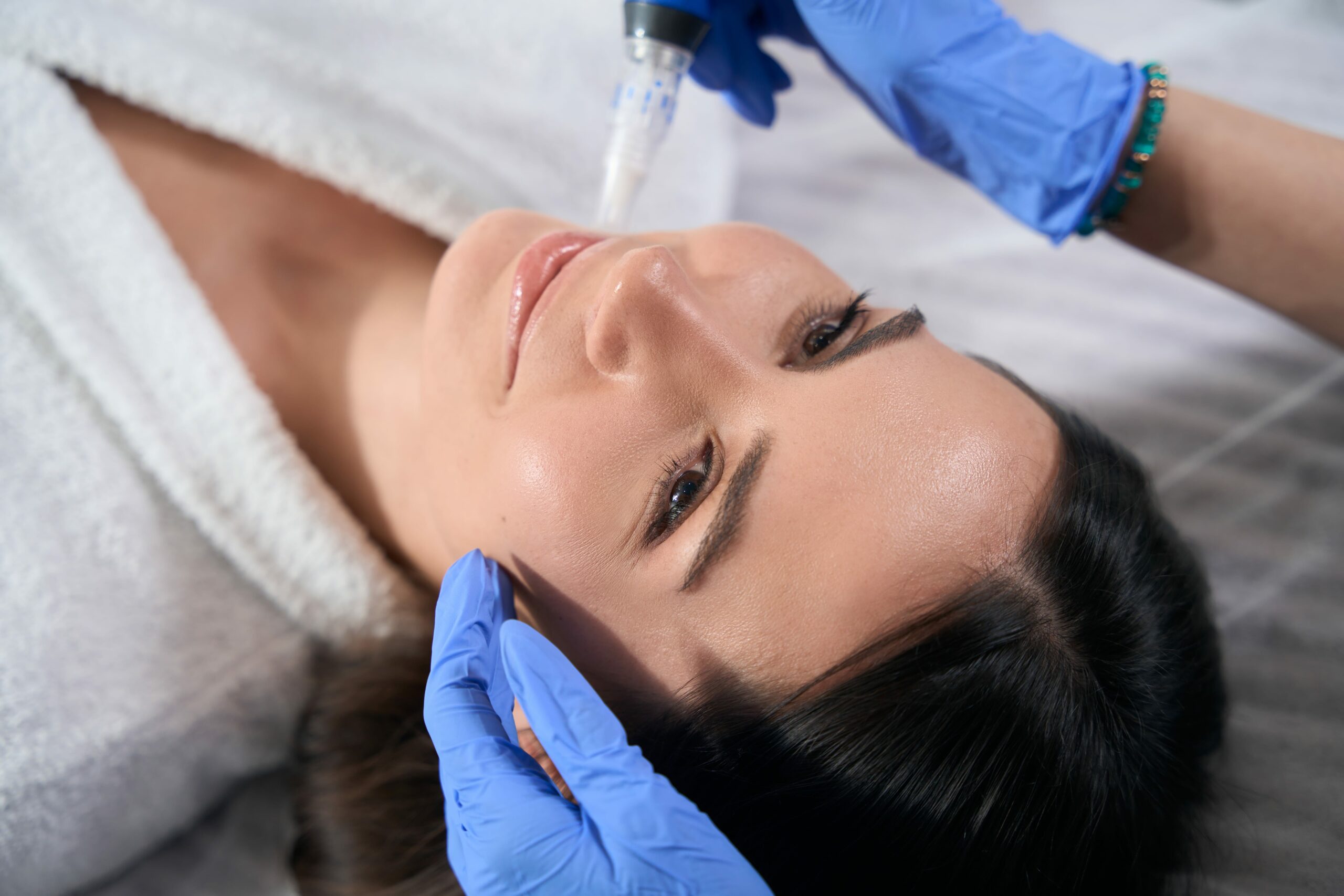 Microneedling | PHDermatology